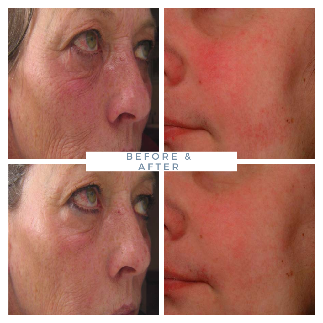 The Morganna’s Alchemy 10 Years Younger Kit: A Holistic Approach to ...