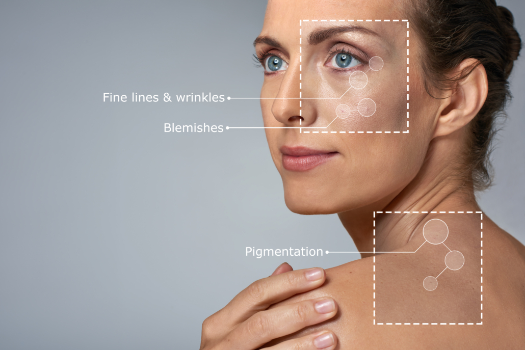 🧬 Collagen Loss: The Real Cause of Aging (Not the Result) — Morganna's ...